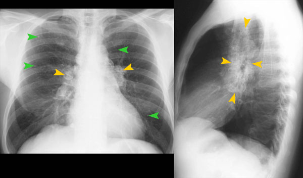 © Institut für Diagnostische Radiologie, UniversitätsSpital Zürich